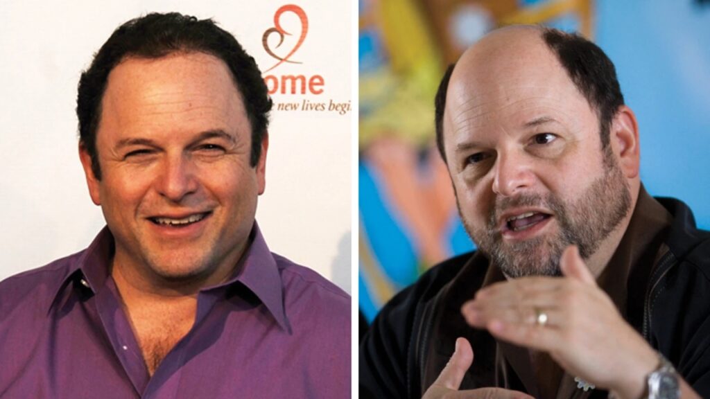 Jason Alexander Plastic Surgery: Unveiling the Transformation in 2023