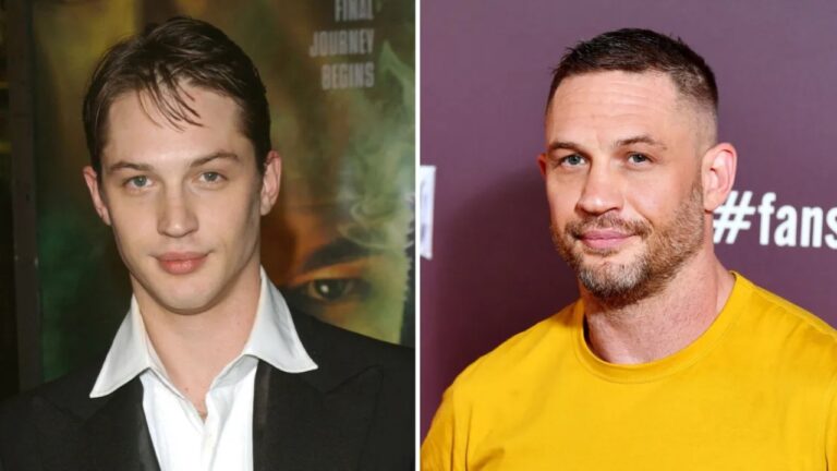 Tom Hardy Plastic Surgery Revealed: Unmasking the Enigma