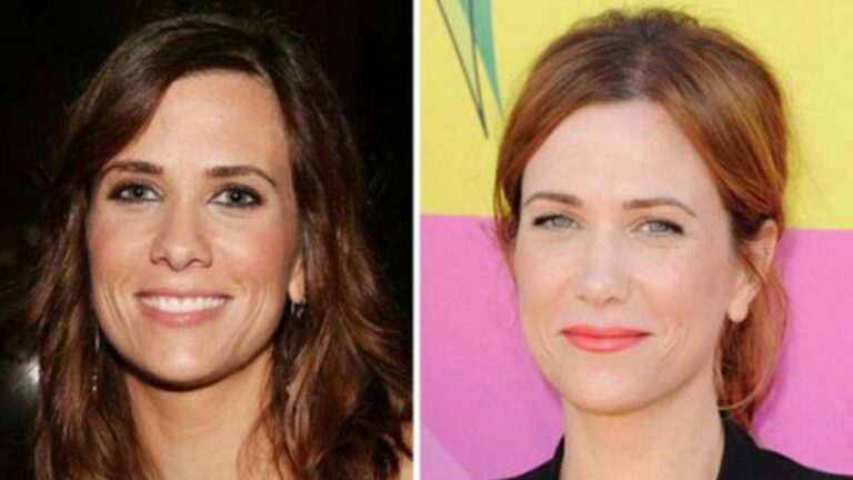 Did Kristen Wiig Get Plastic Surgery? Before & After Picture Examined!