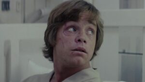 The 1977 Accident That Left Mark Hamill With a Scar