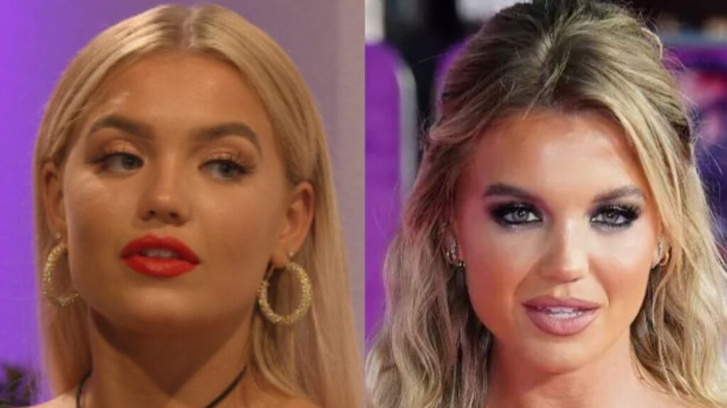 Molly Smith’s Plastic Surgery Boosted Her Confidence!