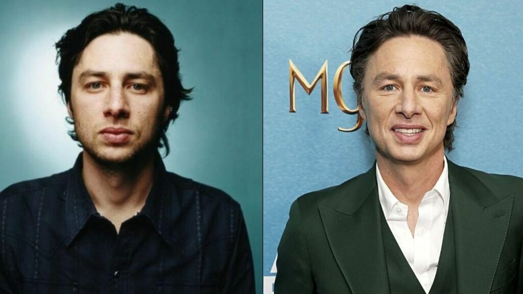 Has Zach Braff Ever Undergone Plastic Surgery?