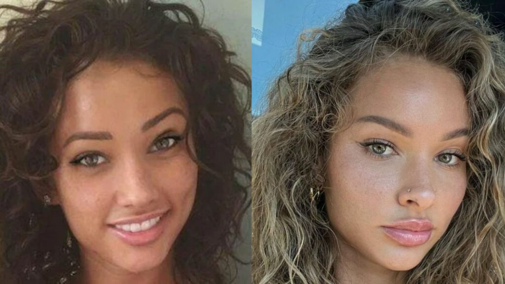 Lolo Wood’s Alleged Plastic Surgery Includes a Nose Job, Facelift & More